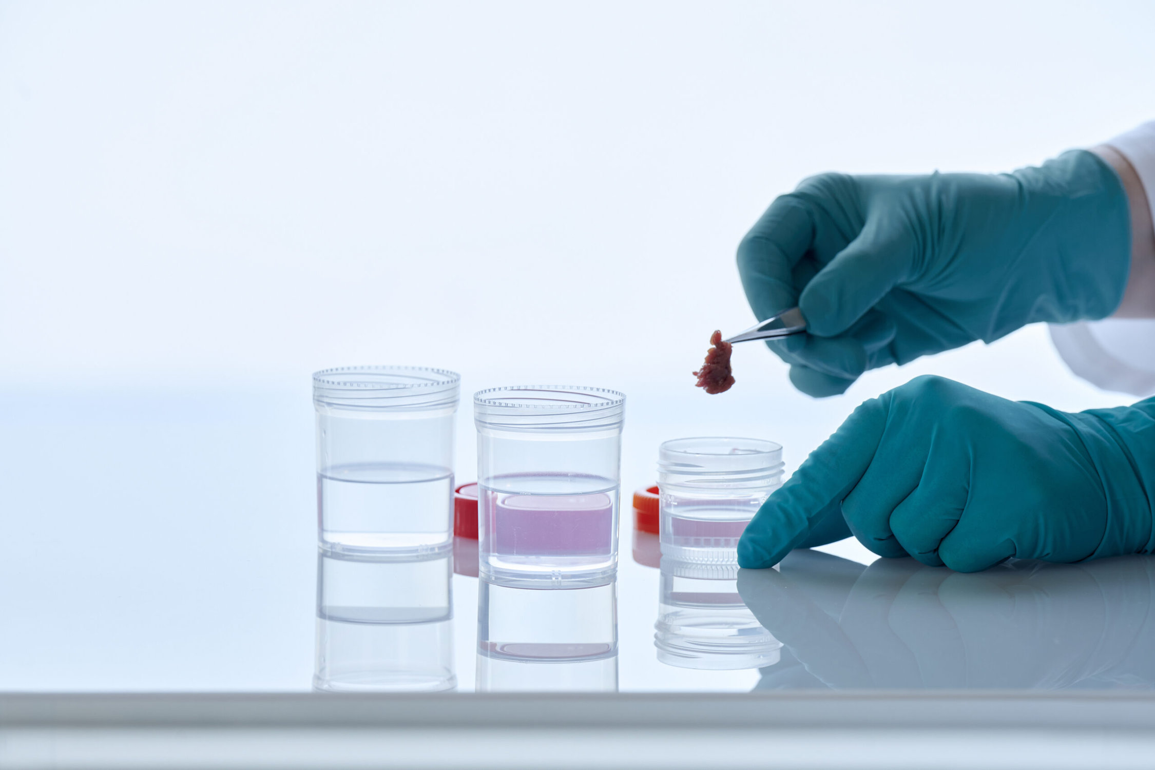 BIOPSY HANDLING AND OCCUPATIONAL HEALTH: RISK, REGULATIONS AND SOLUTIONS - Axlab : Axlab.