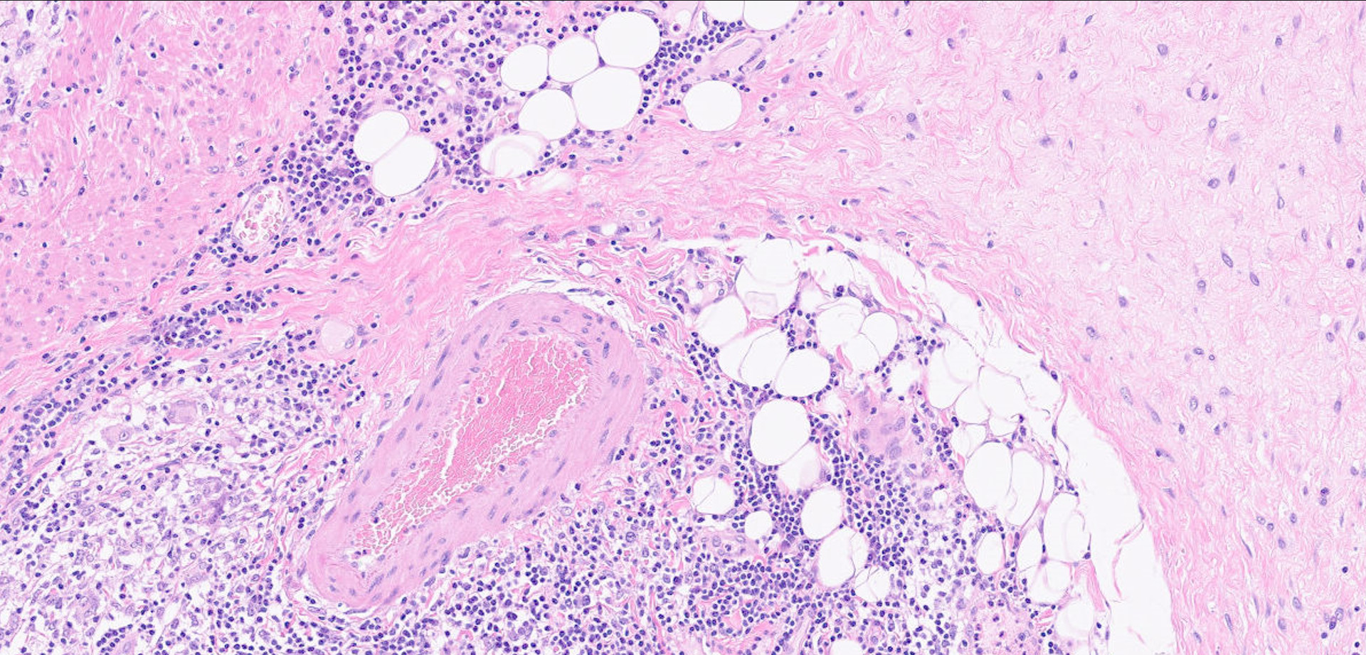 Activities - Axlab : Axlab.